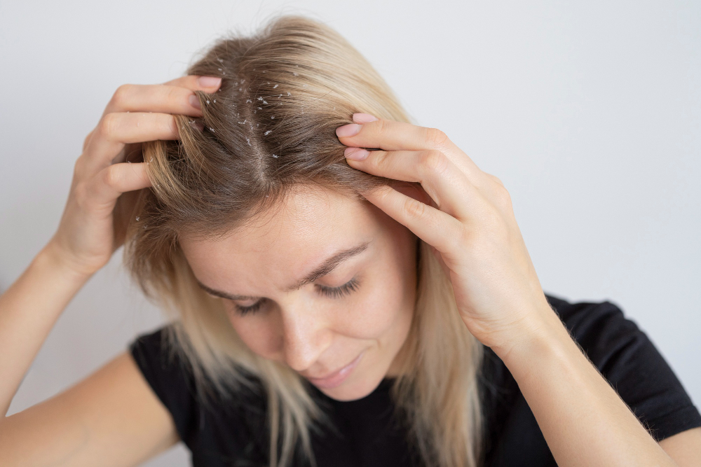 Bed Bugs Vs Lice How To Identify Them